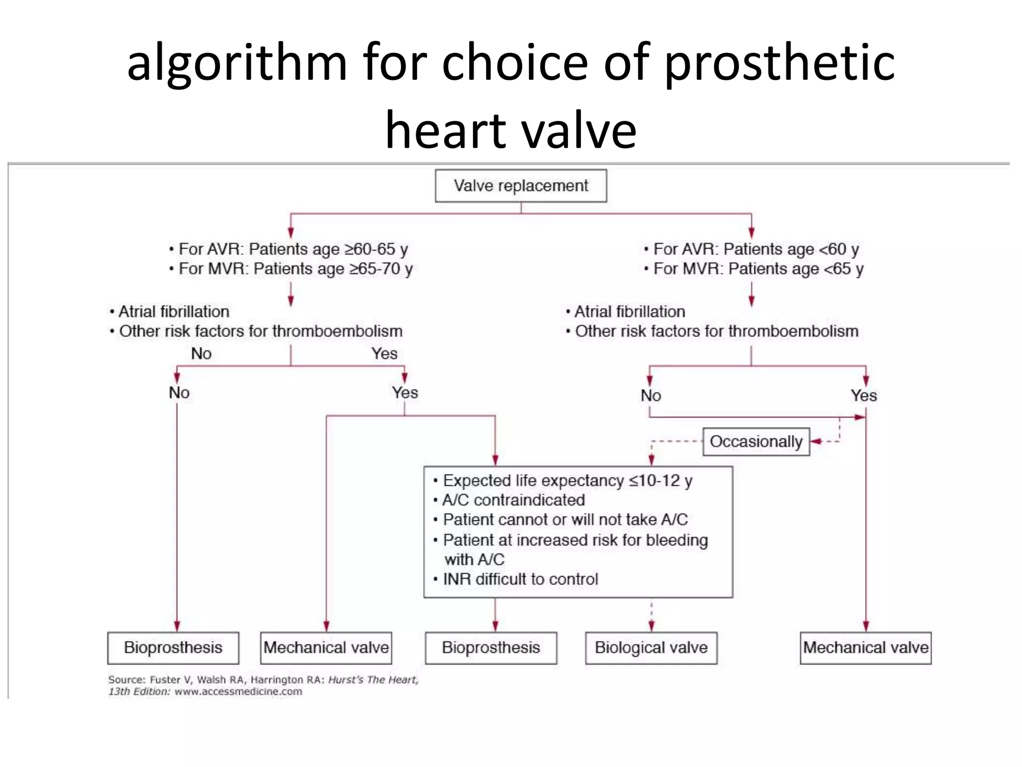 Prosthetic valves-.ppsx