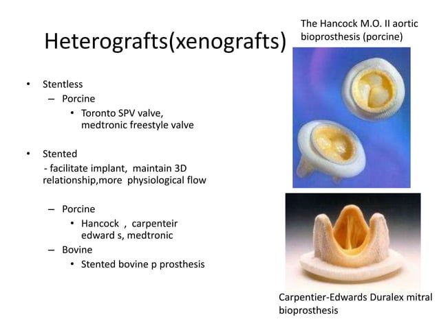 Prosthetic valves-.ppsx