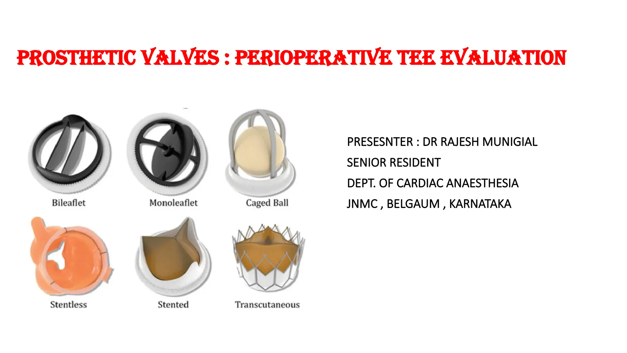 PROSTHETIC VALVES-perioperative echo evaluation.pptx