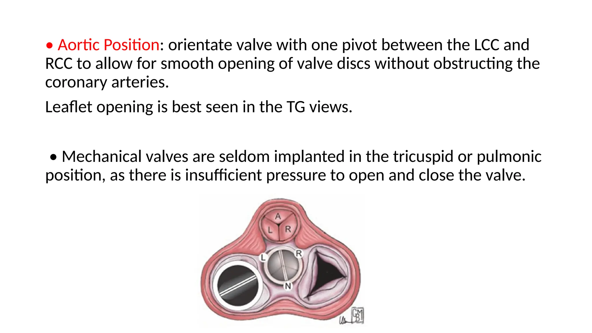 PROSTHETIC VALVES-perioperative echo evaluation.pptx