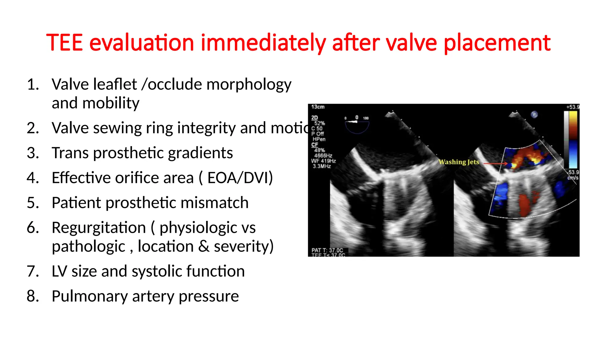 PROSTHETIC VALVES-perioperative echo evaluation.pptx