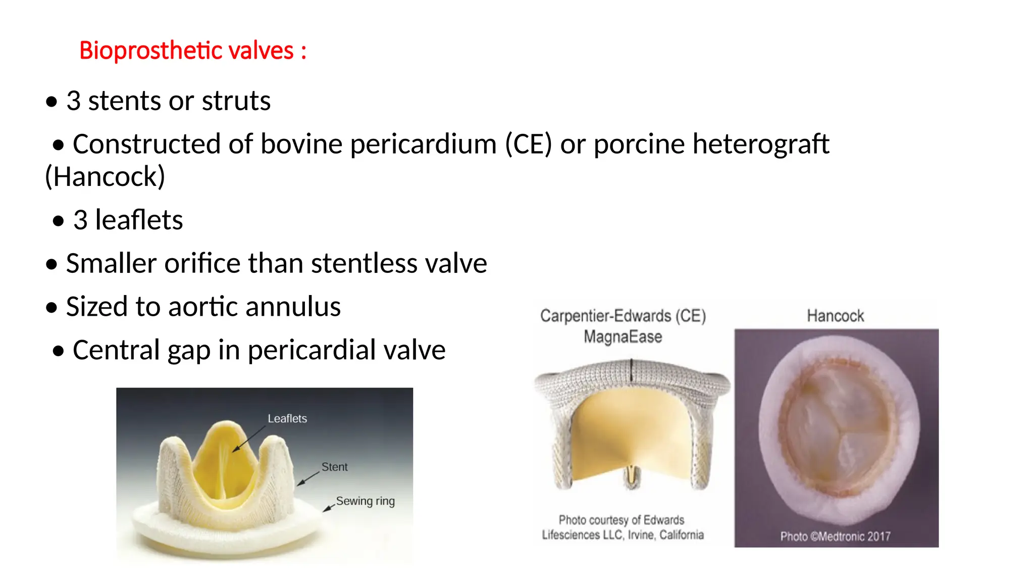 PROSTHETIC VALVES-perioperative echo evaluation.pptx
