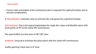 PROSTHETIC VALVES-perioperative echo evaluation.pptx
