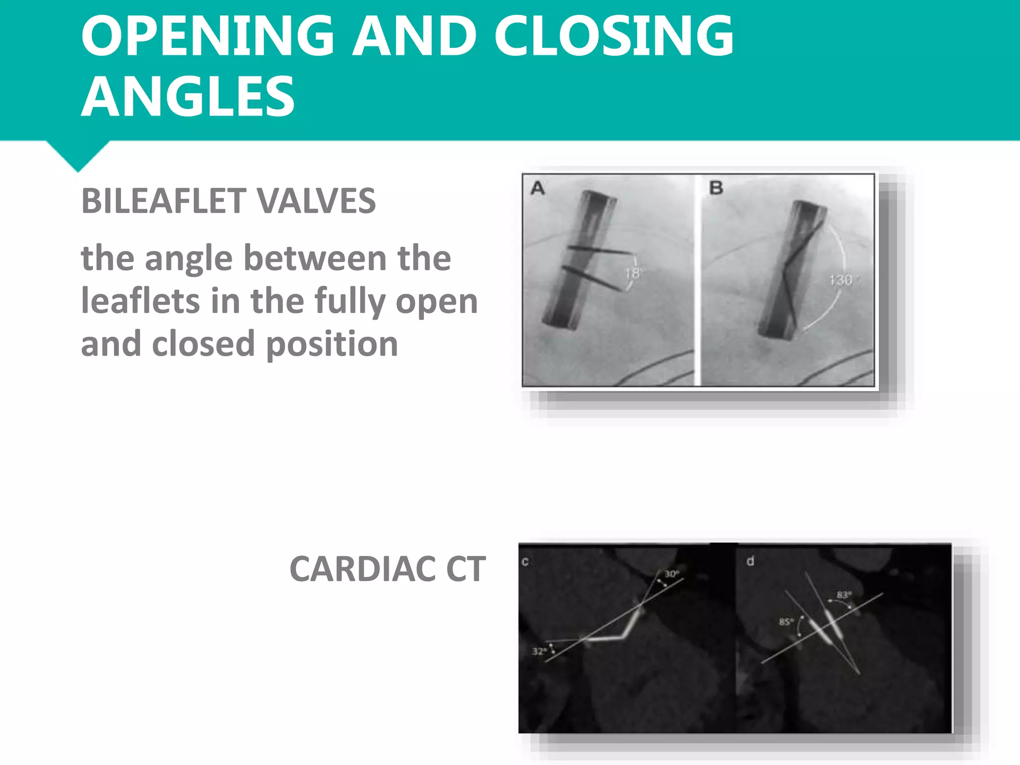Prosthetic heart valves types physiology | PPTX