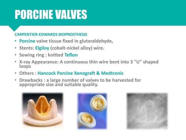 Prosthetic heart valves types physiology | PPTX