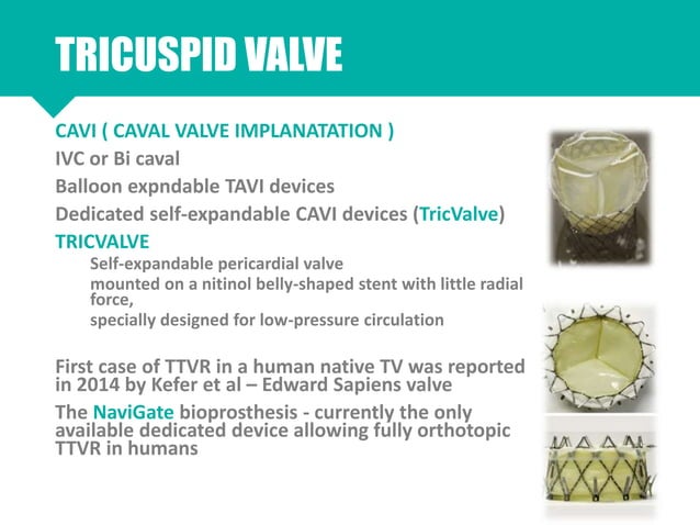 Prosthetic heart valves types physiology | PPTX