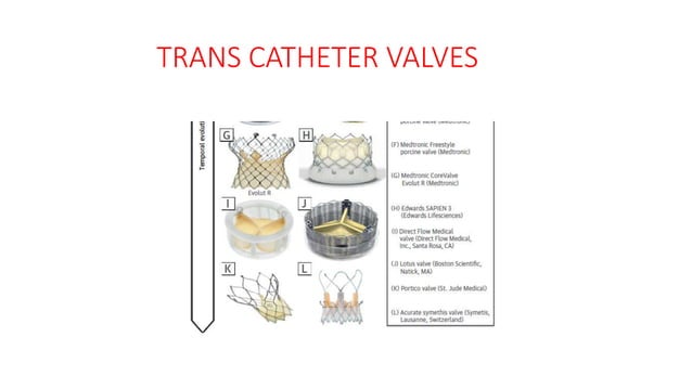 Prosthetic valve thrombosis | PPTX