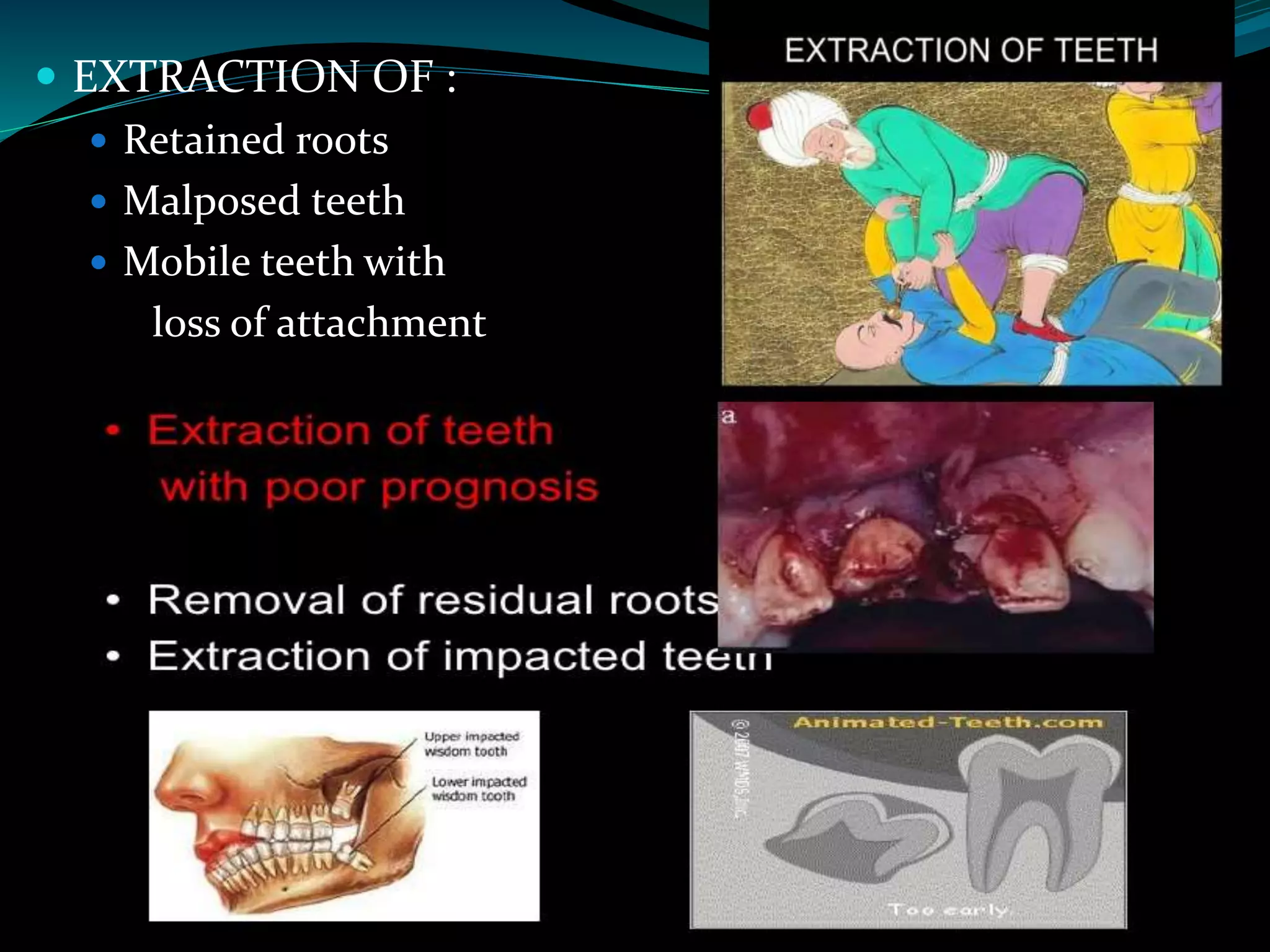 PRE PROSTHETIC FULL MOUTH PREPARATION | PPTX