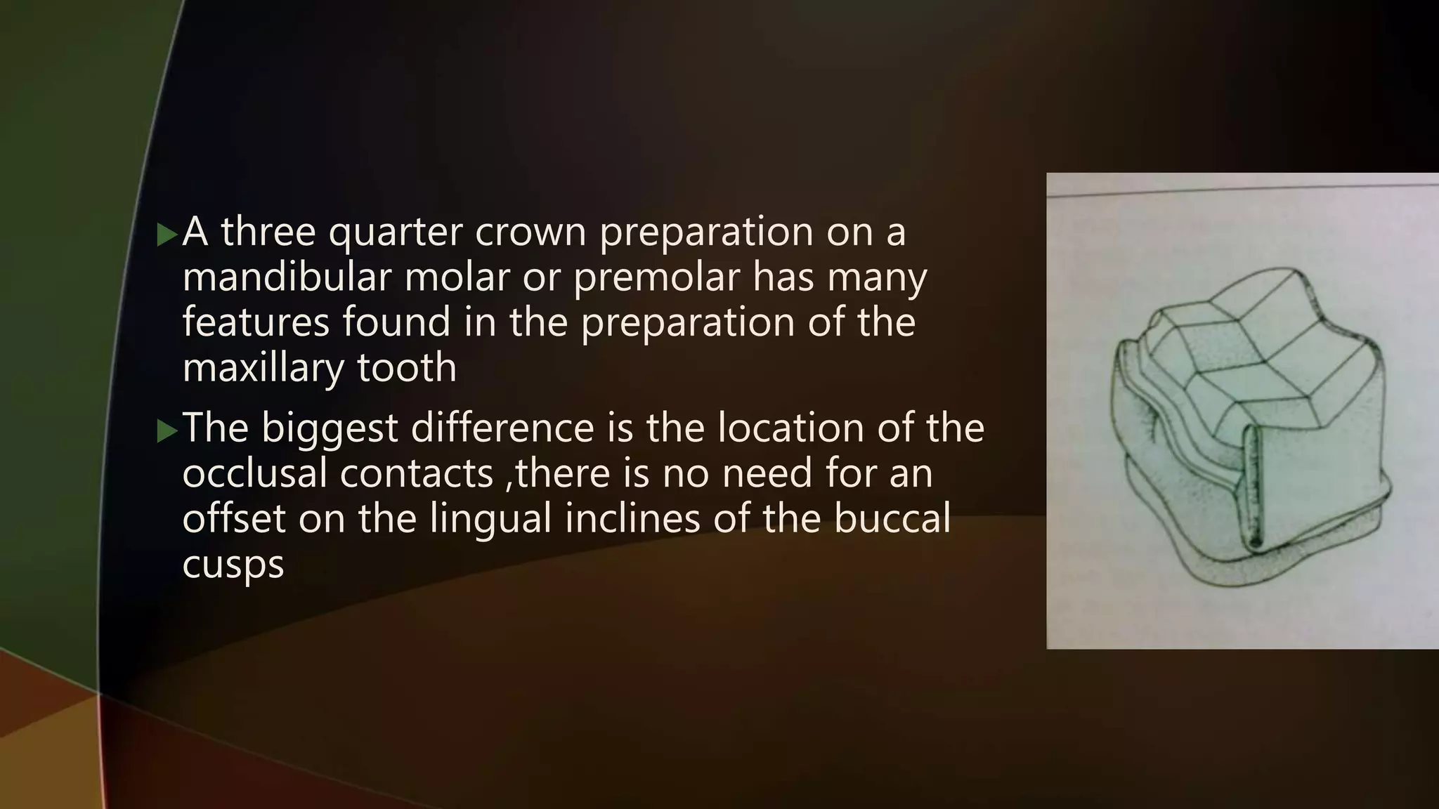 Partial veneer crown preparations | PPTX