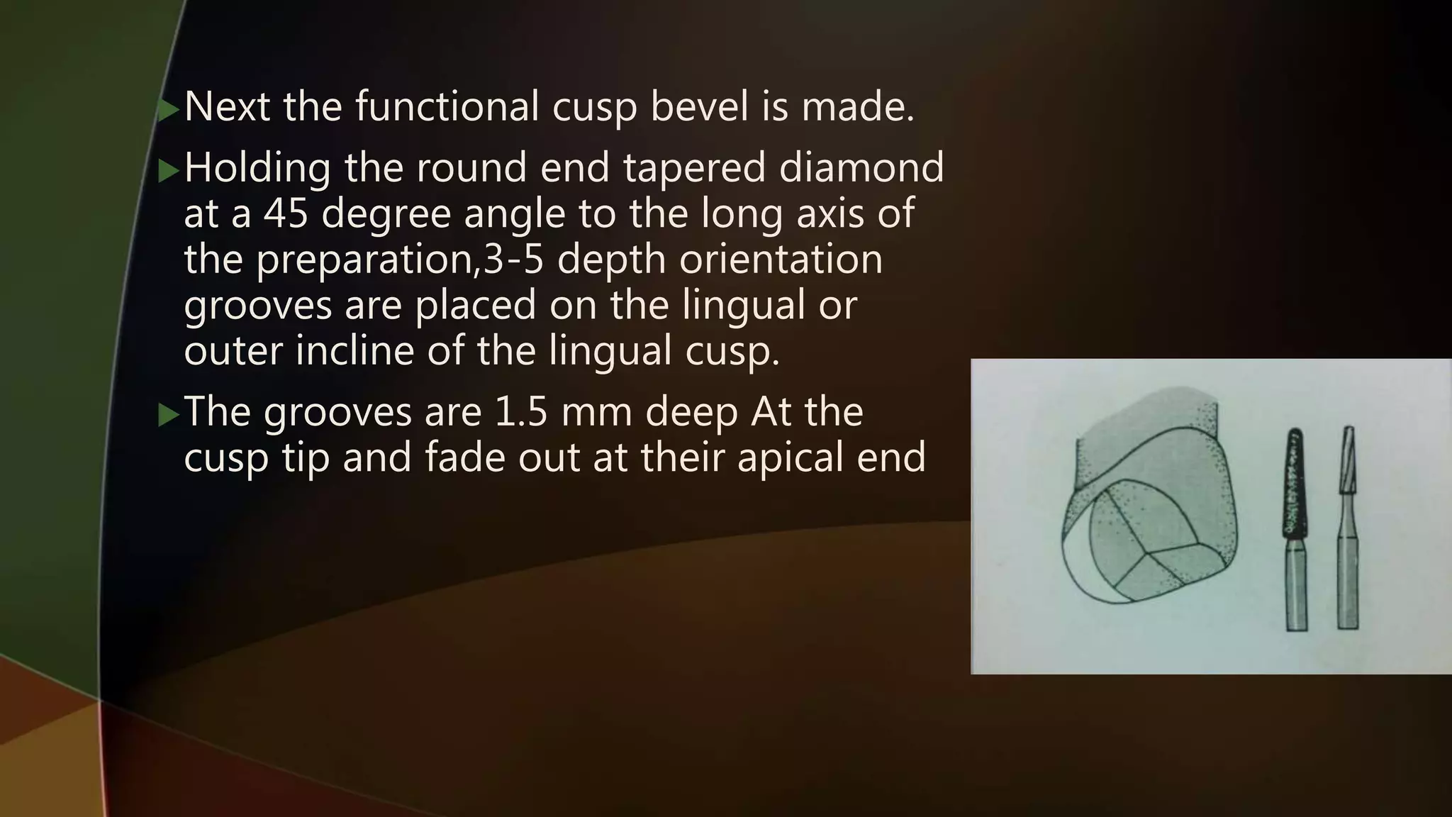 Partial veneer crown preparations | PPTX