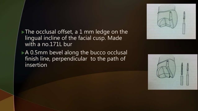 Partial veneer crown preparations | PPTX