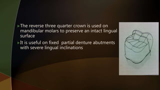 Partial veneer crown preparations | PPTX