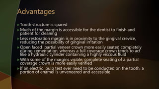 Partial veneer crown preparations | PPTX