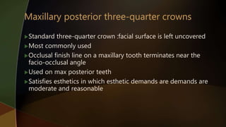Partial veneer crown preparations | PPTX