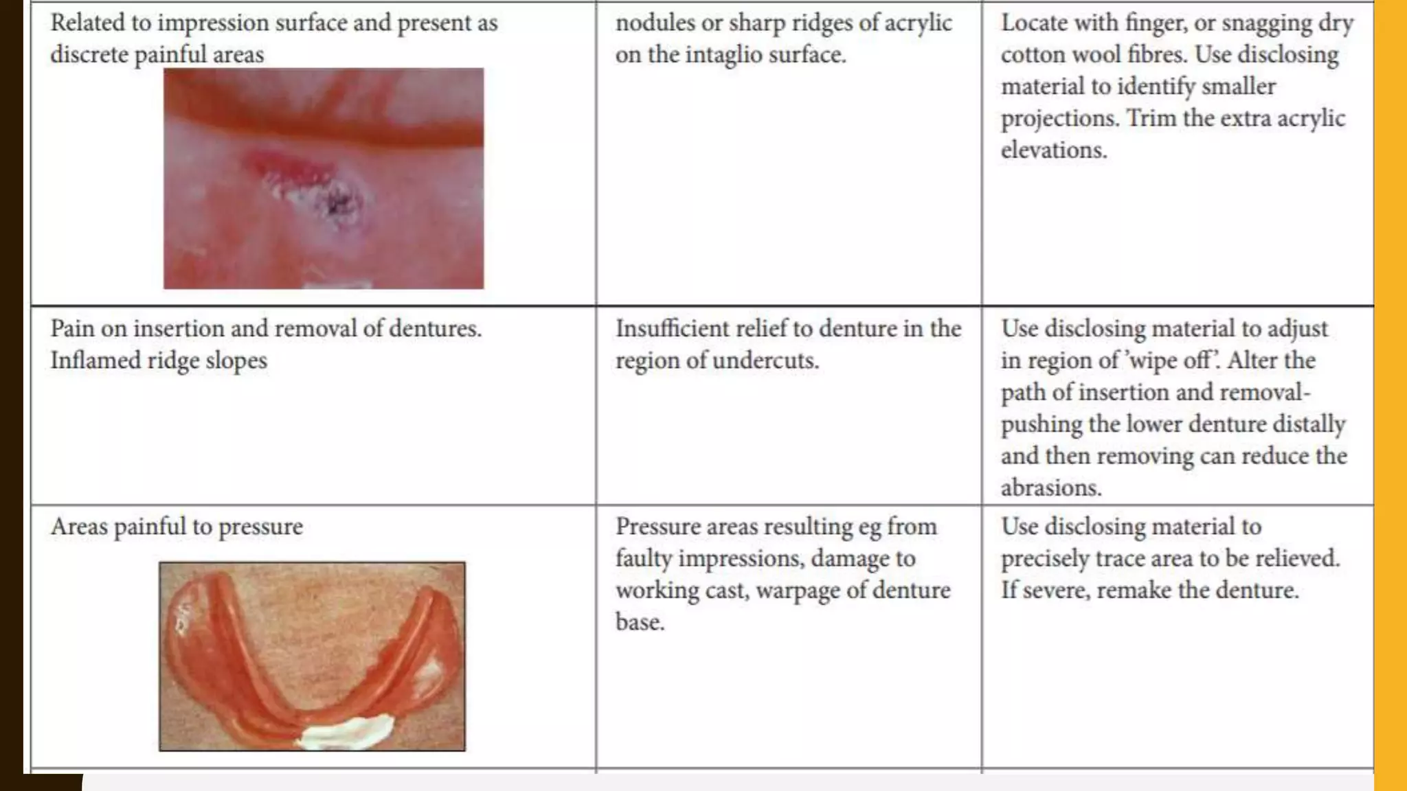 Post insertion problems in complete dentures | PPTX