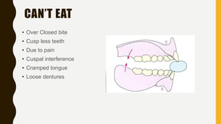 Post insertion problems in complete dentures | PPTX