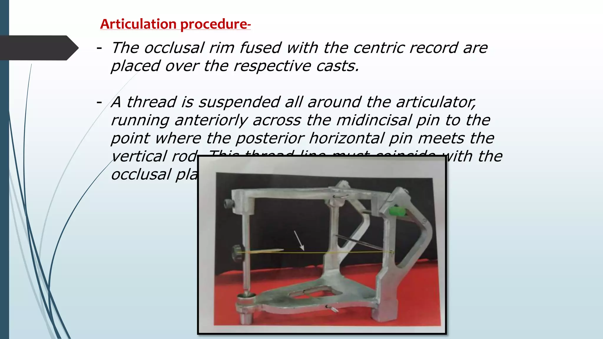 Hinge and Mean value articulator | PPTX