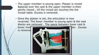 Hinge and Mean value articulator | PPTX
