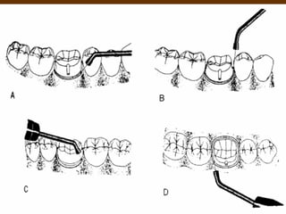 prostho-perio interdisciplanary approcah in fpd.ppt