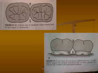 prostho-perio interdisciplanary approcah in fpd.ppt