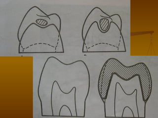 prostho-perio interdisciplanary approcah in fpd.ppt