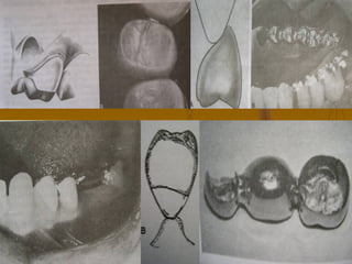 prostho-perio interdisciplanary approcah in fpd.ppt