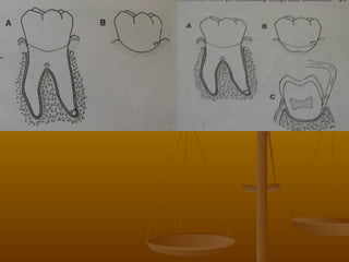 prostho-perio interdisciplanary approcah in fpd.ppt