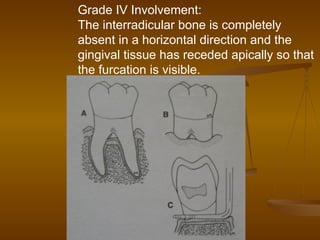 prostho-perio interdisciplanary approcah in fpd.ppt