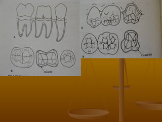 prostho-perio interdisciplanary approcah in fpd.ppt
