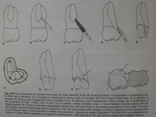 prostho-perio interdisciplanary approcah in fpd.ppt