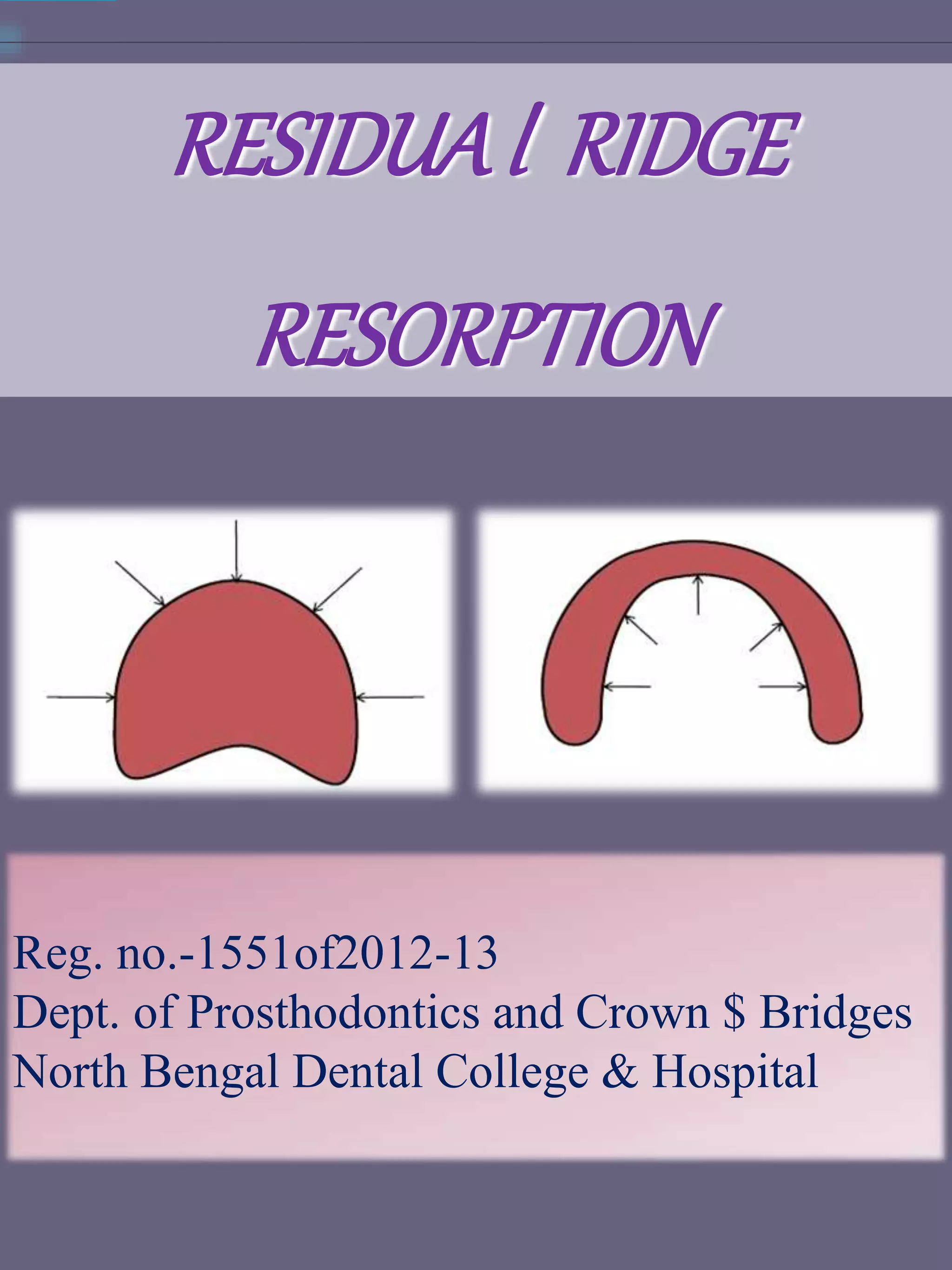 Residual Ridge Resorption | PPTX