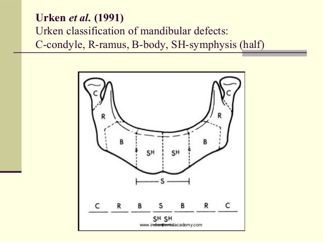 Prosthodontic management of acquired defects of mandible123 /certifie…
