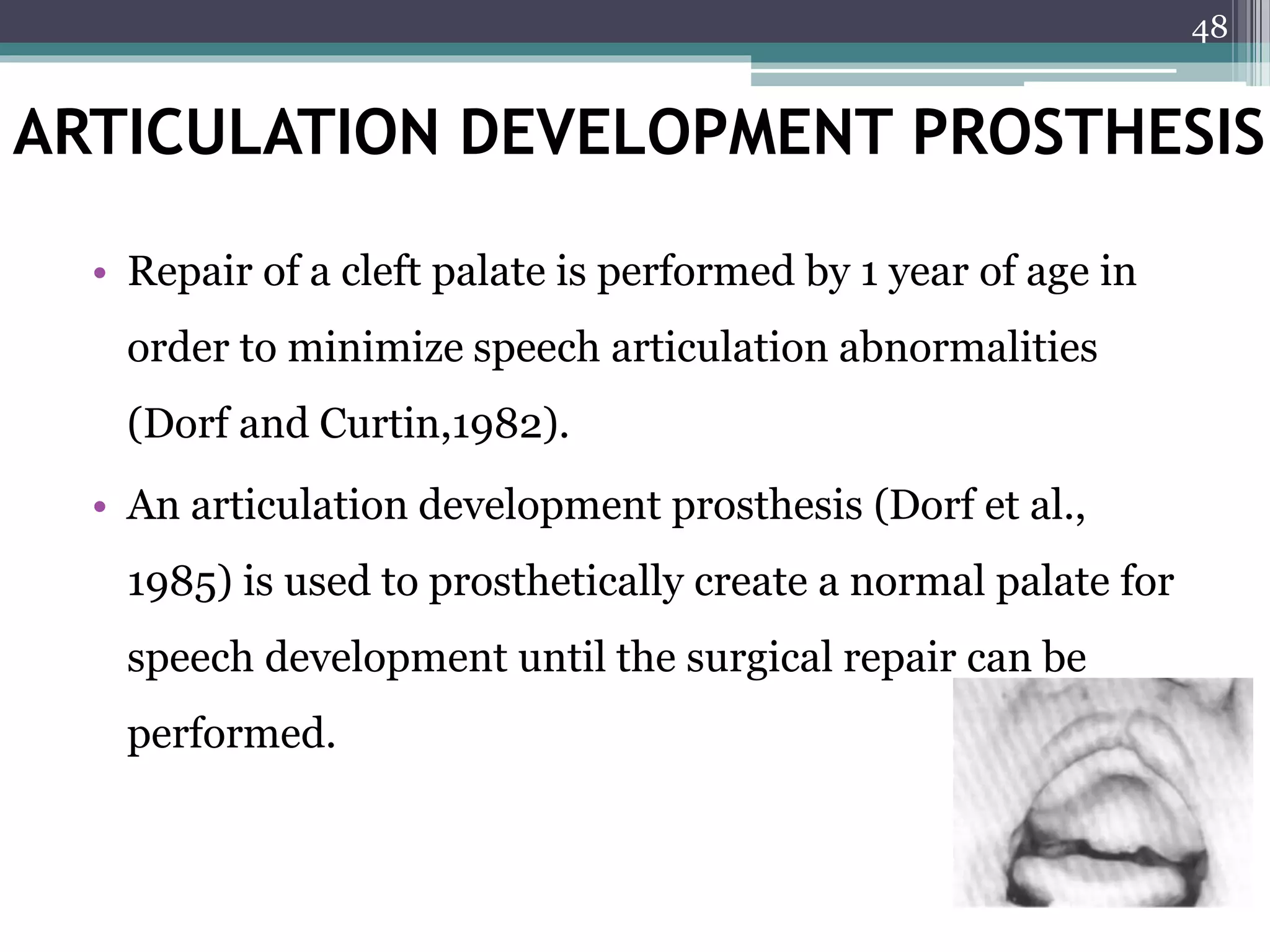 Prosthodontic management of cleft lip and palate | PPTX | Ear, Nose and Throat Conditions ...