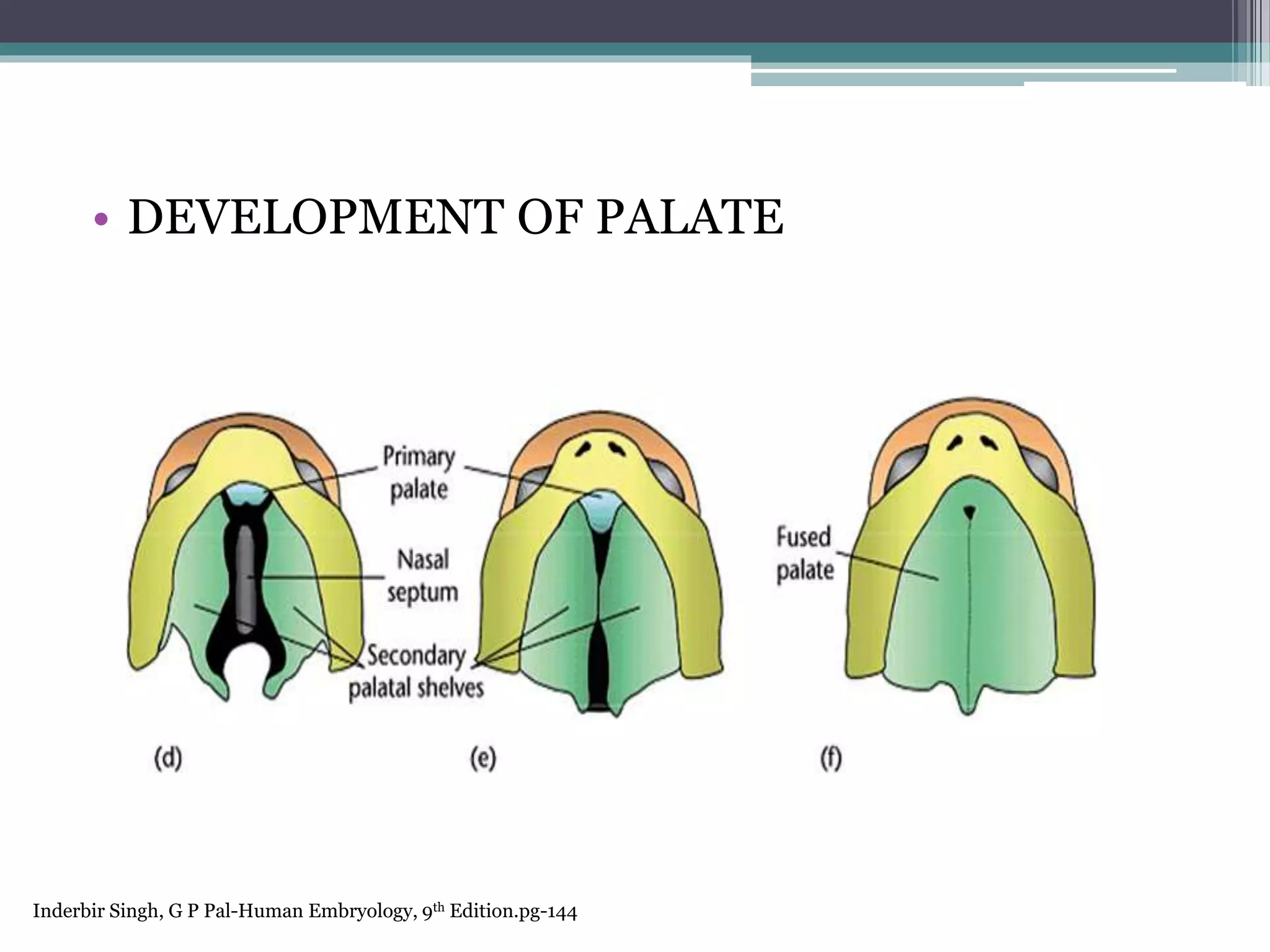 Prosthodontic management of cleft lip and palate | PPTX