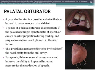 Prosthodontic management of cleft lip and palate | PPTX