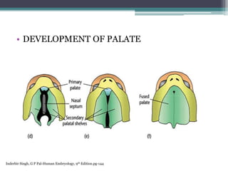 Prosthodontic management of cleft lip and palate | PPTX