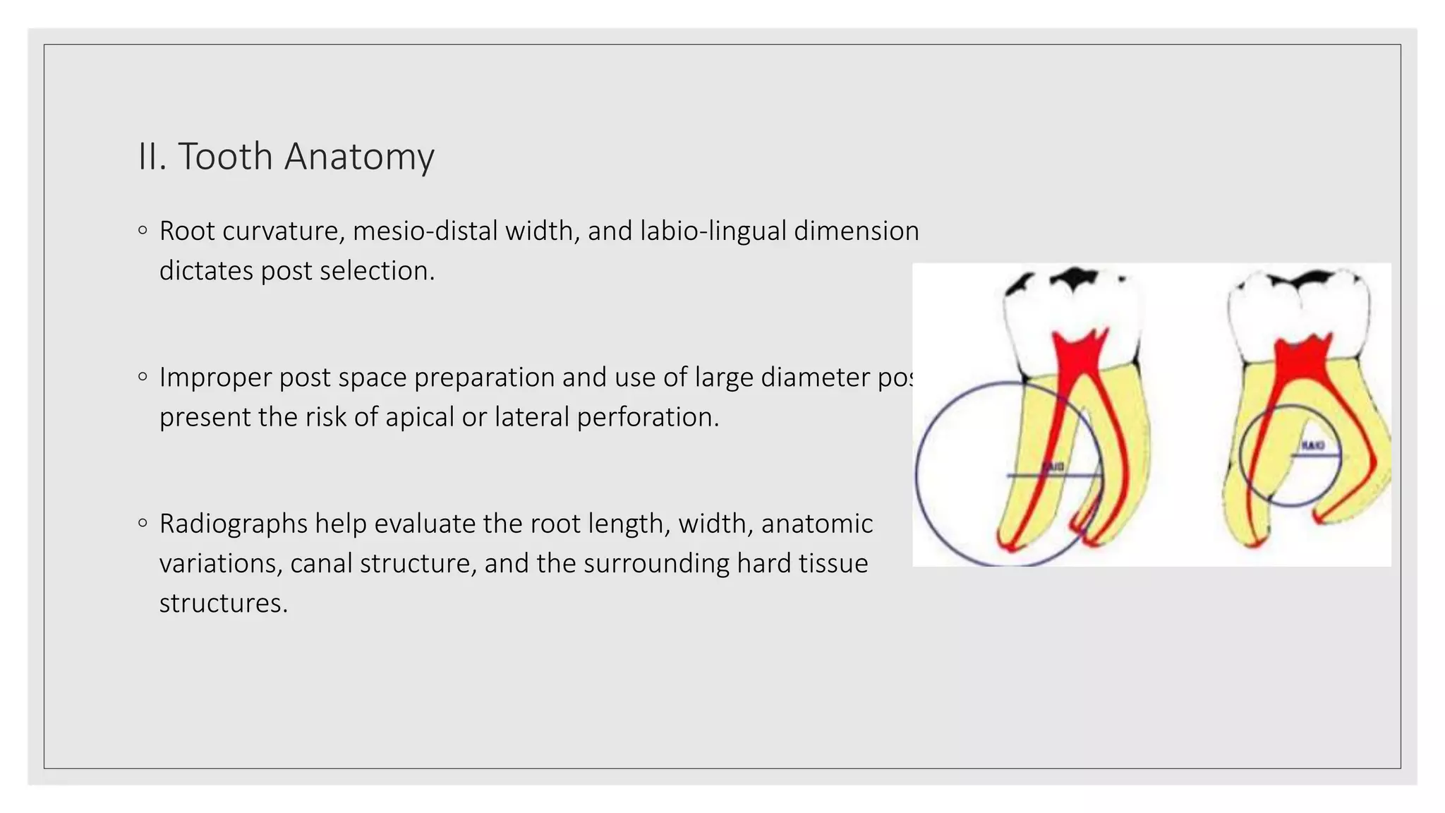 Prosthodontic management of endodontically treated teeth [autosaved] | PPTX