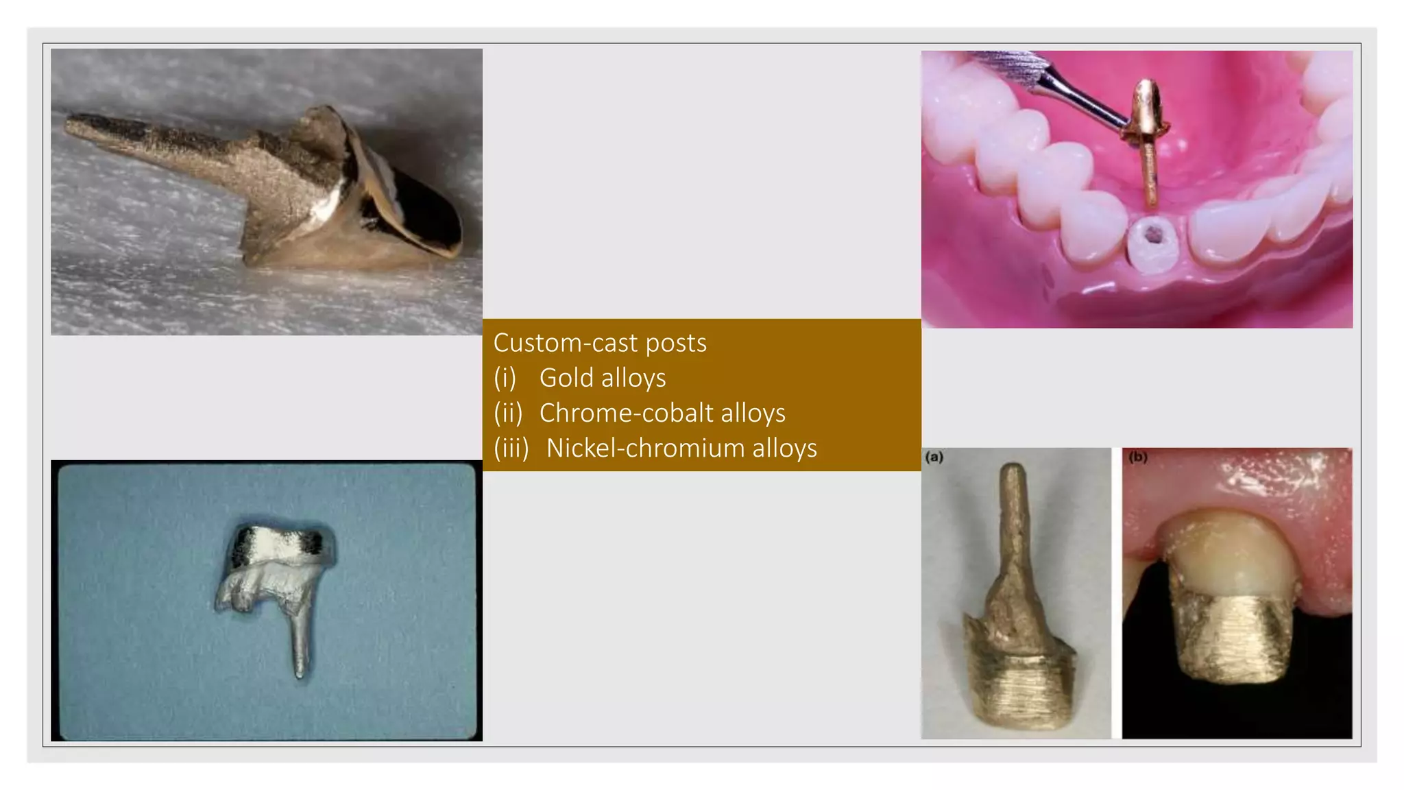 Prosthodontic management of endodontically treated teeth [autosaved] | PPTX