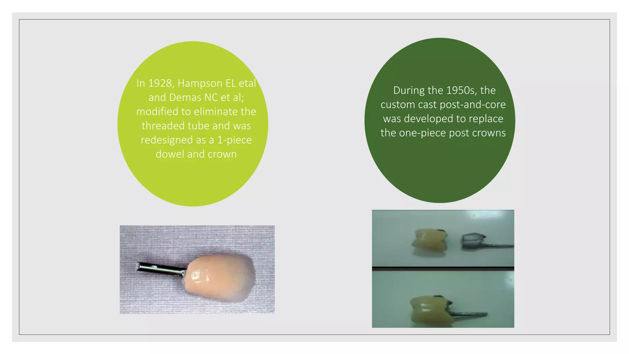 Prosthodontic management of endodontically treated teeth [autosaved] | PPTX