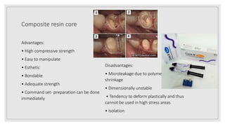 Prosthodontic management of endodontically treated teeth [autosaved] | PPTX