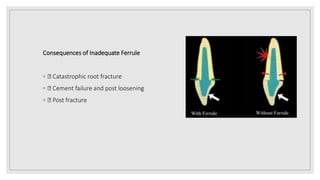 Prosthodontic management of endodontically treated teeth [autosaved ...
