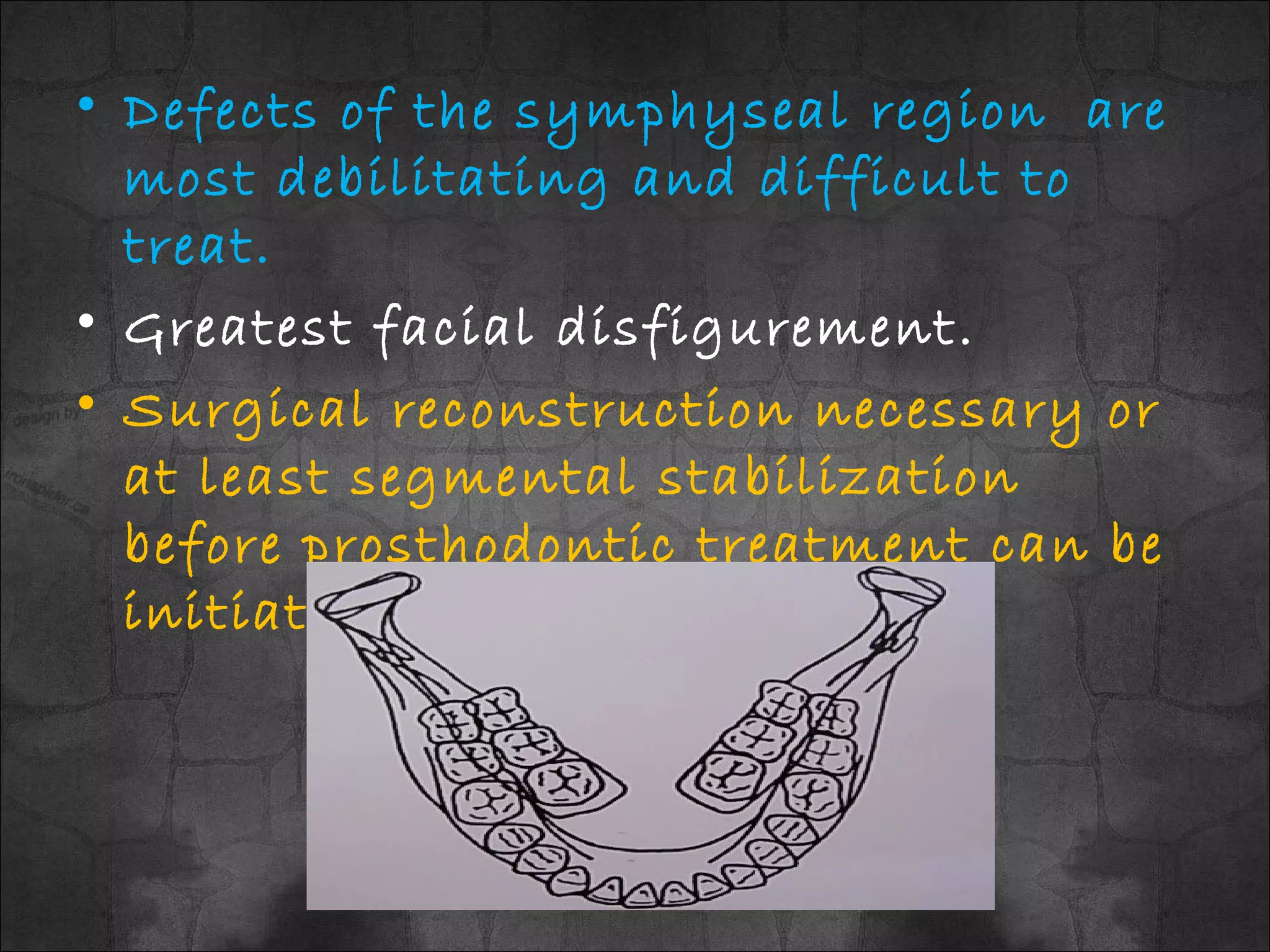 Prosthodontic Management of Mandibular Defects | PPT