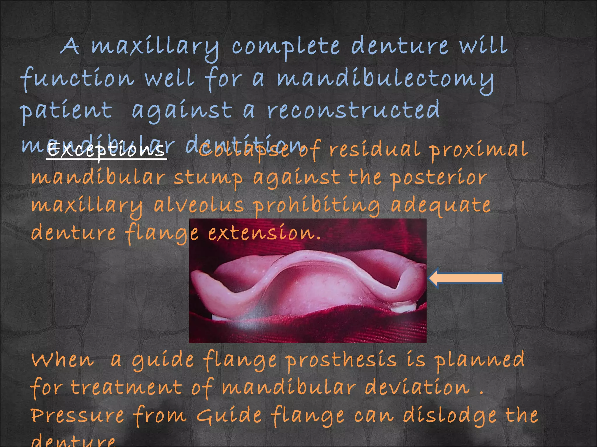 Prosthodontic Management of Mandibular Defects | PPT