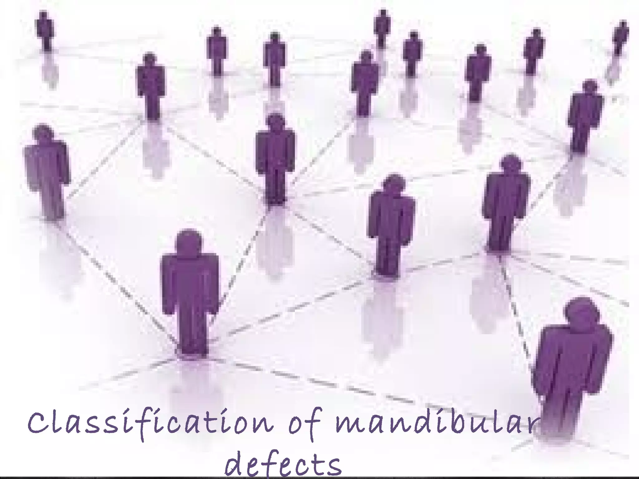 Prosthodontic Management of Mandibular Defects | PPT