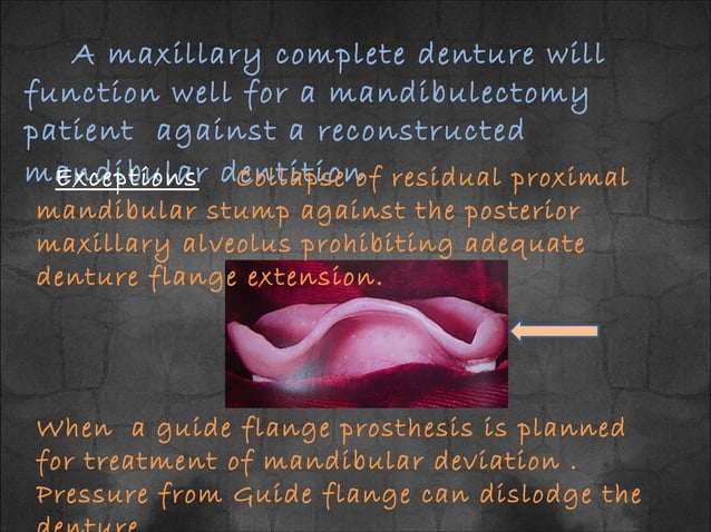 Prosthodontic Management of Mandibular Defects | PPT