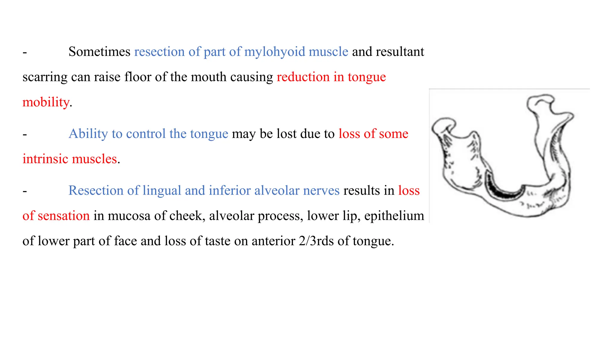 PROSTHODONTIC MANAGEMENT OF MANDIBULAR DEFECTS.pptx