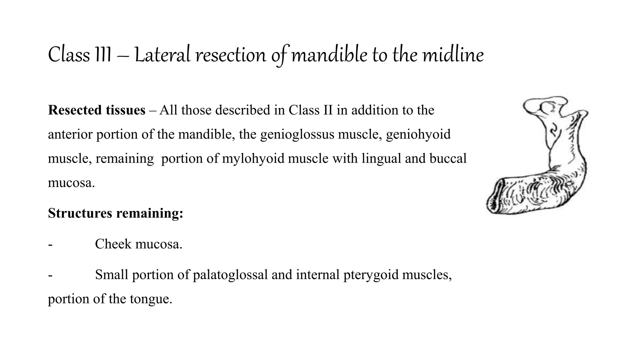 PROSTHODONTIC MANAGEMENT OF MANDIBULAR DEFECTS.pptx