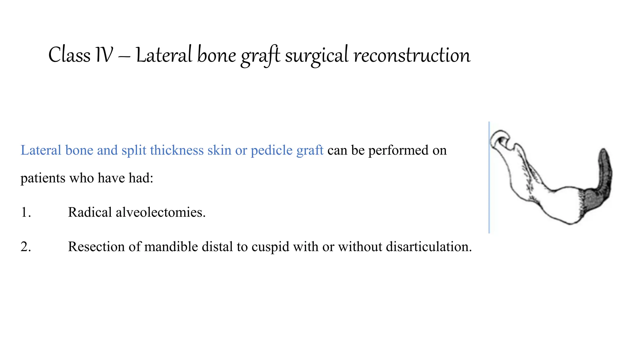 PROSTHODONTIC MANAGEMENT OF MANDIBULAR DEFECTS.pptx