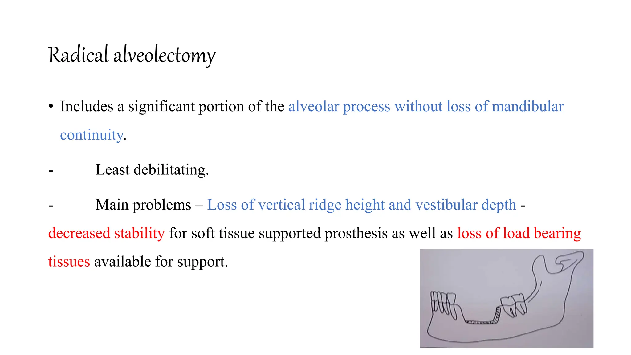 PROSTHODONTIC MANAGEMENT OF MANDIBULAR DEFECTS.pptx