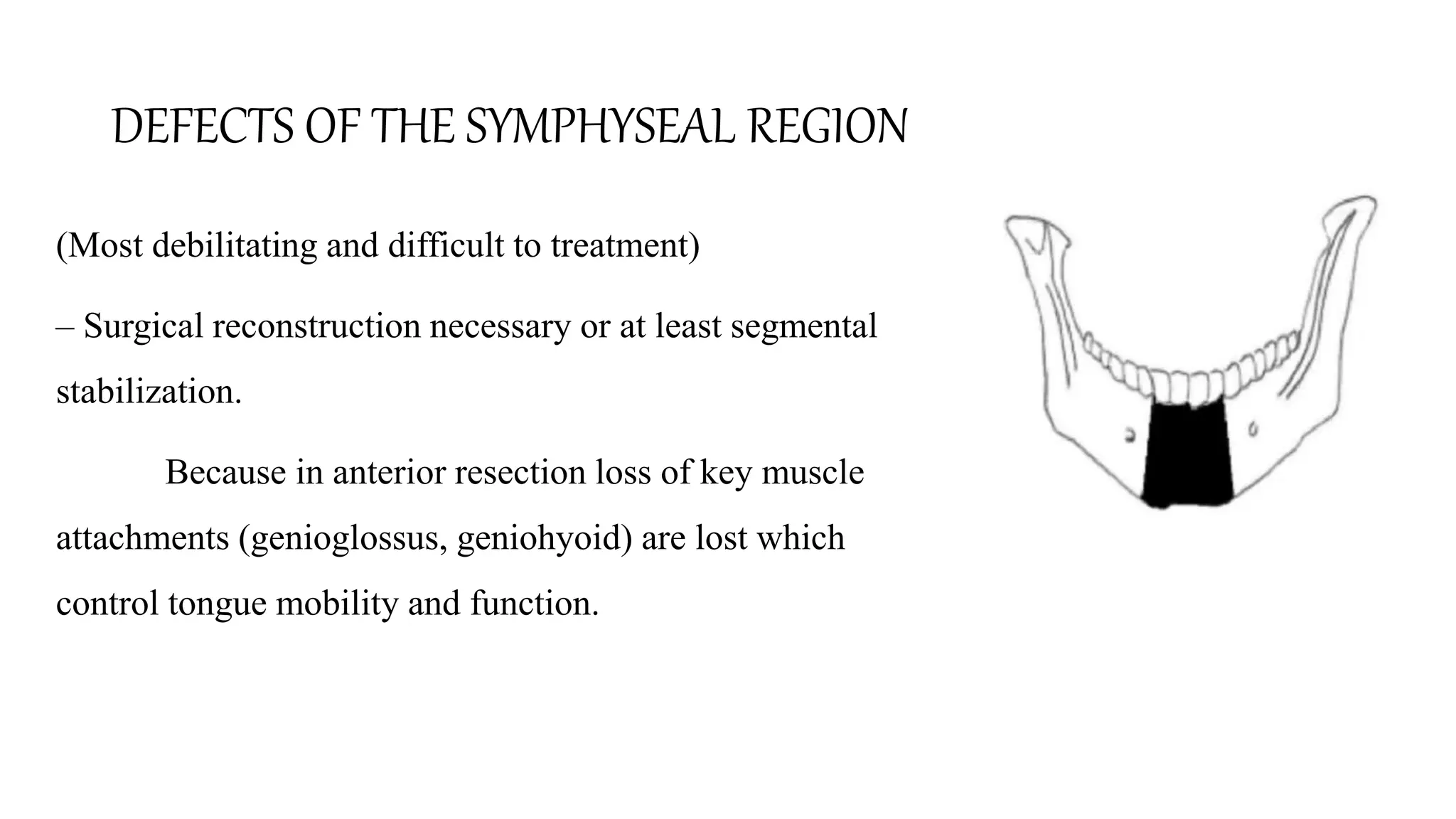 PROSTHODONTIC MANAGEMENT OF MANDIBULAR DEFECTS.pptx